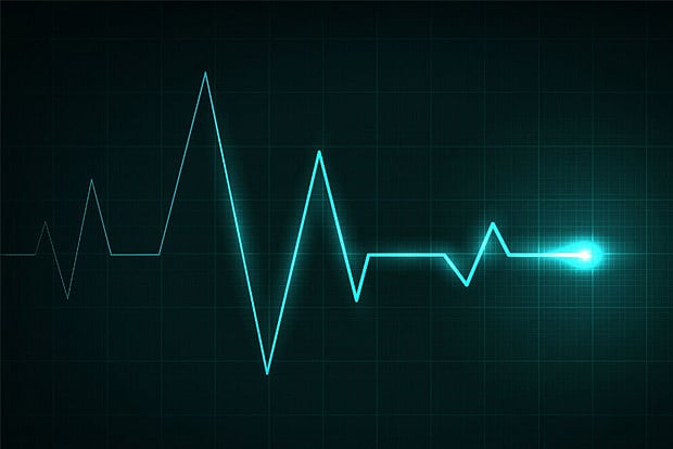 AI tool to predict life expectancy in heart failure patients