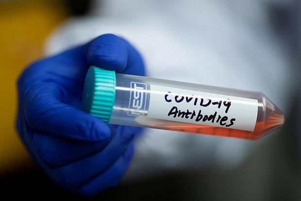 US approves new coronavirus antigen test with fast results