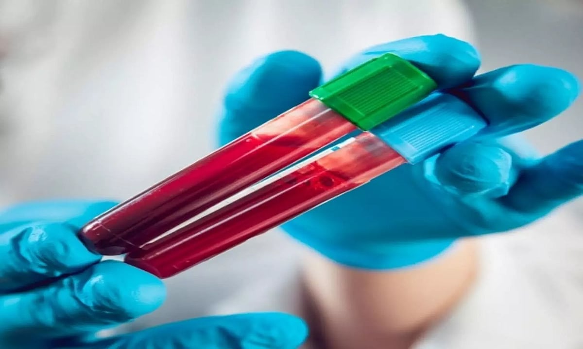 14 children undergoing blood transfusions at UP hospital test positive ...