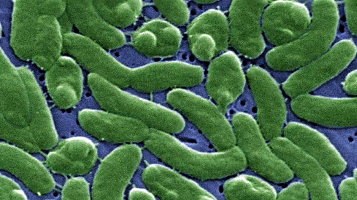 US woman loses all 4 limbs due to bacterial infection from fish