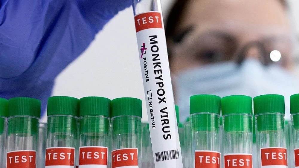 Suspected monkeypox case in Kerala, samples sent for testing