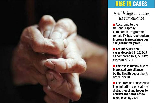 Tamil Nadu sets target of eliminating Leprosy at block-level by 2020