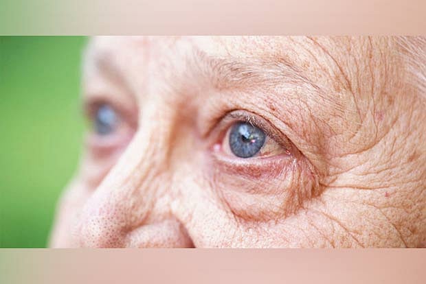 Blurry vision at old age? Check for AMD, say doctors