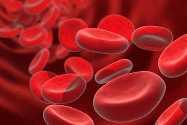 Anemia in early pregnancy linked with risk for neurodevelopmental disorders