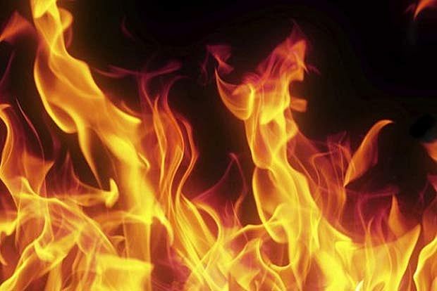 5 kids severely injured in UP blaze