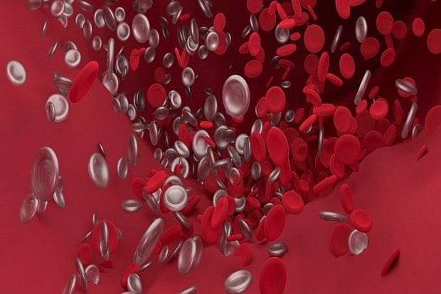 Mechanical blood clot removal showed positive results in half of stroke ...