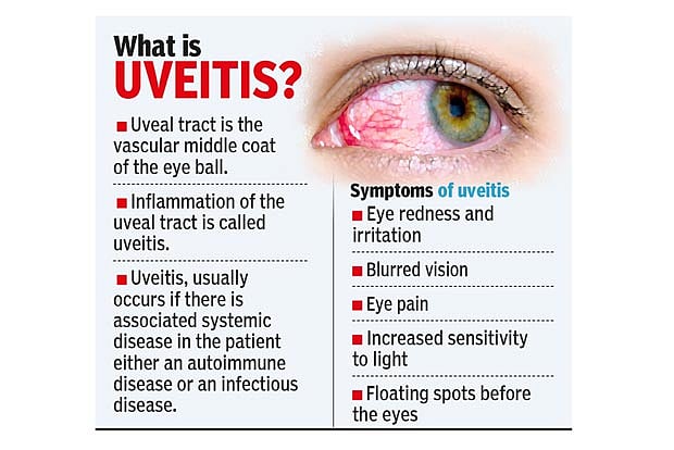 causes uveitis