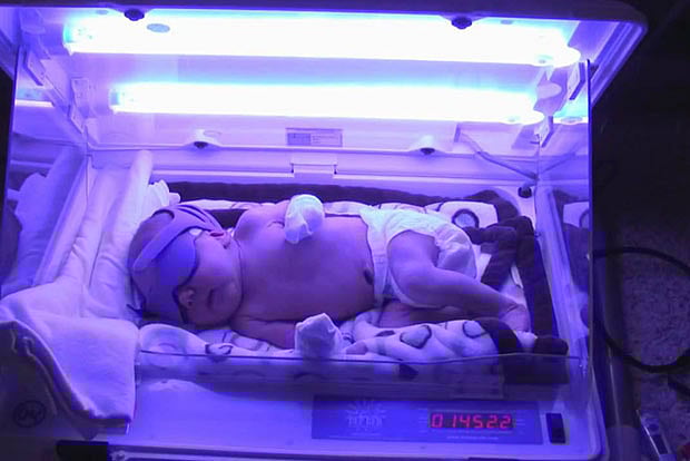 43rd annual convention of National Neonatology Forum of India held