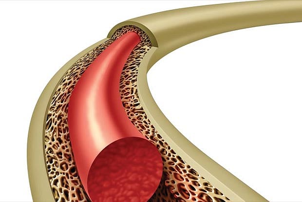 GH gets bone marrow transplant unit