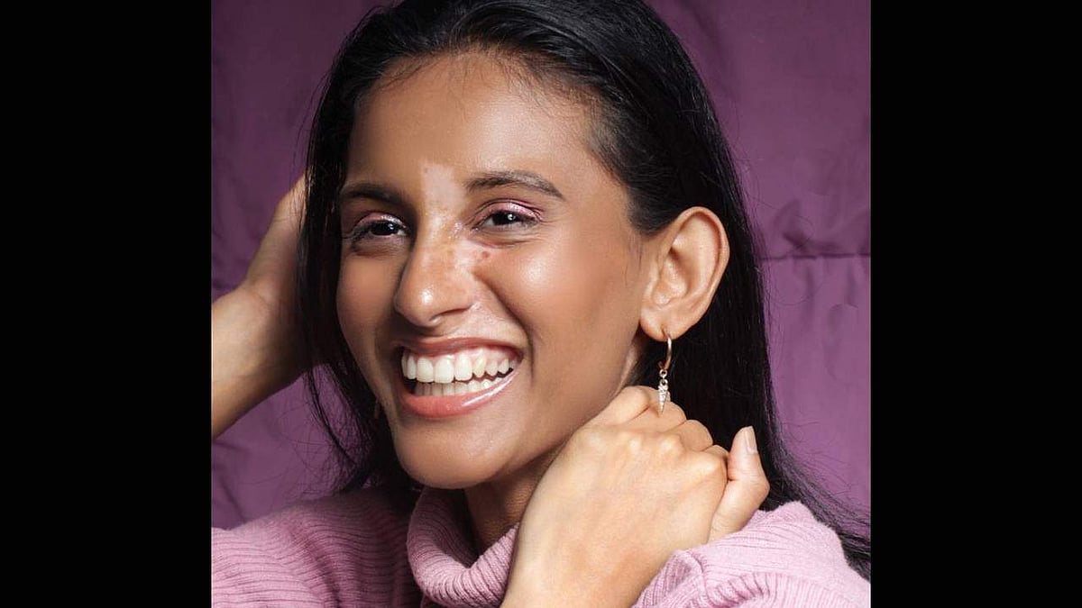 My classmates called me 'the mask': How 24-year-old Prarthana Jagan ...