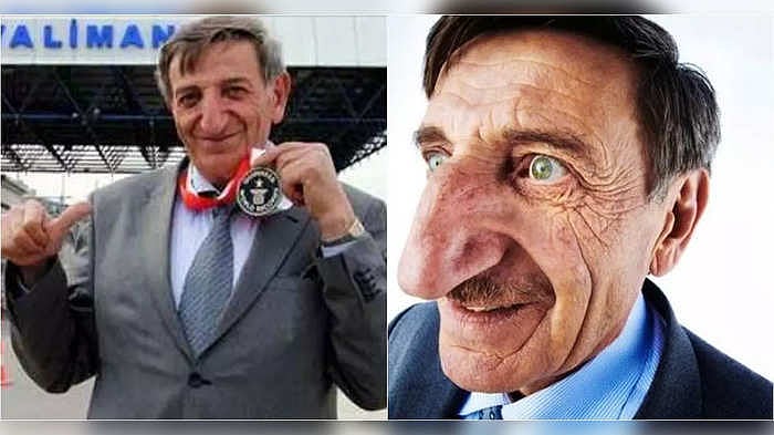 World's Longest Nose : লম্বা নাকের জন্য গিনেস ওয়ার্ল্ড রেকর্ডে নাম ...
