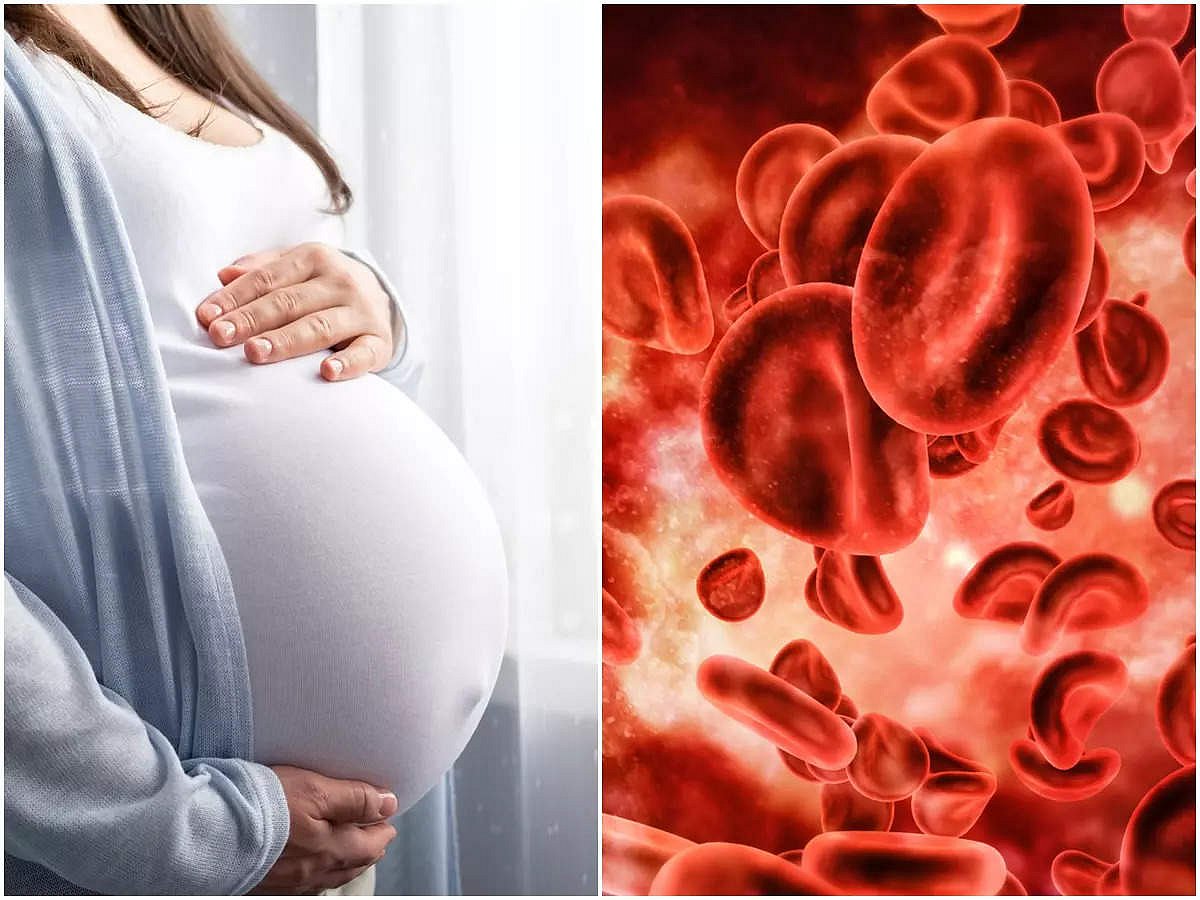 Signs And Symptoms Of Iron Deficiency Anemia In Pregnancy ...