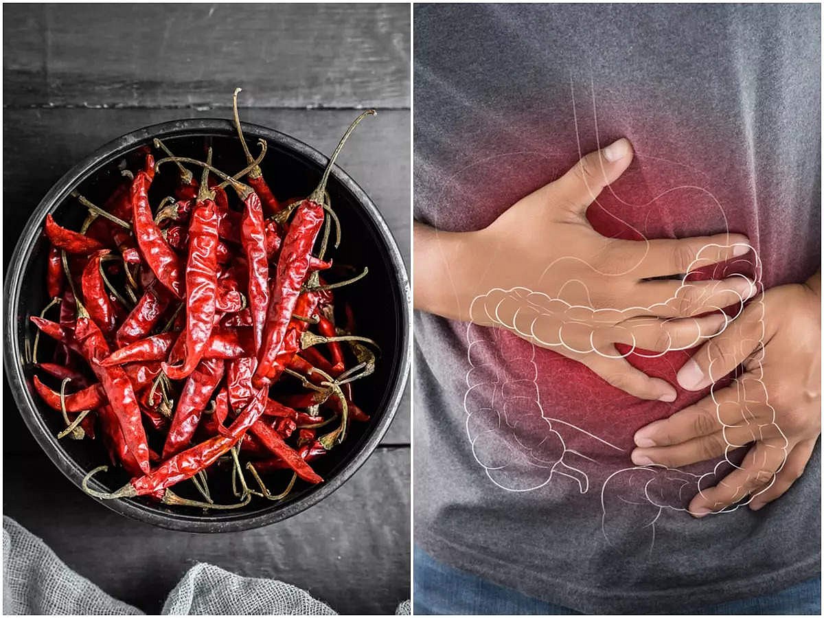 Red Chillli Side Effects: রান্নায় মেশান নাকি অত্যধিক শুকনো লঙ্কা? জানেন কি, এমন খাবার রোজ খেলে ...