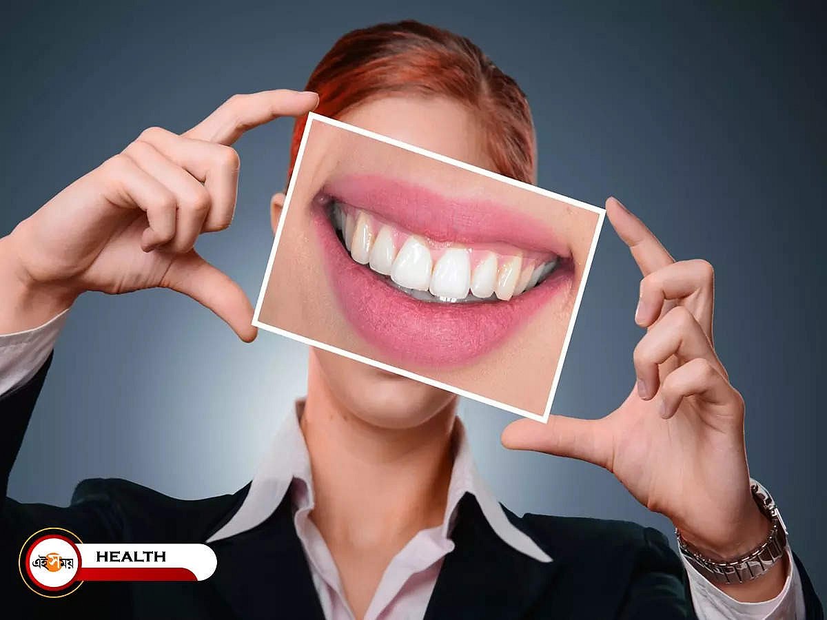 Yellow Teeth Home Remedy Bengali Health News | হলুদ দাঁত হবে দুধ সাদা ...