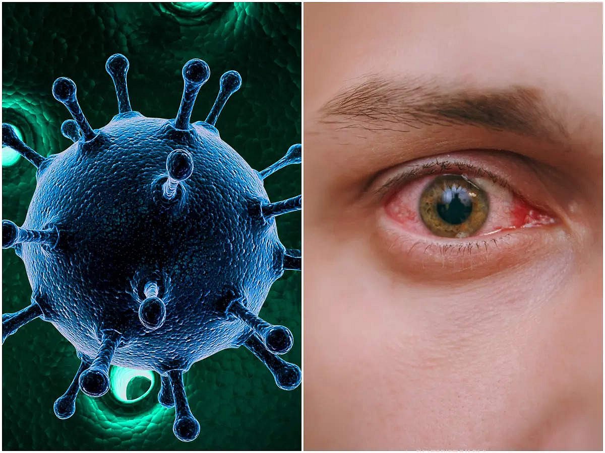 Covid 4th Wave,Covid 4th Wave: করোনায় সেরে ওঠার পরও অদ্ভুত উপসর্গ পিছু ...