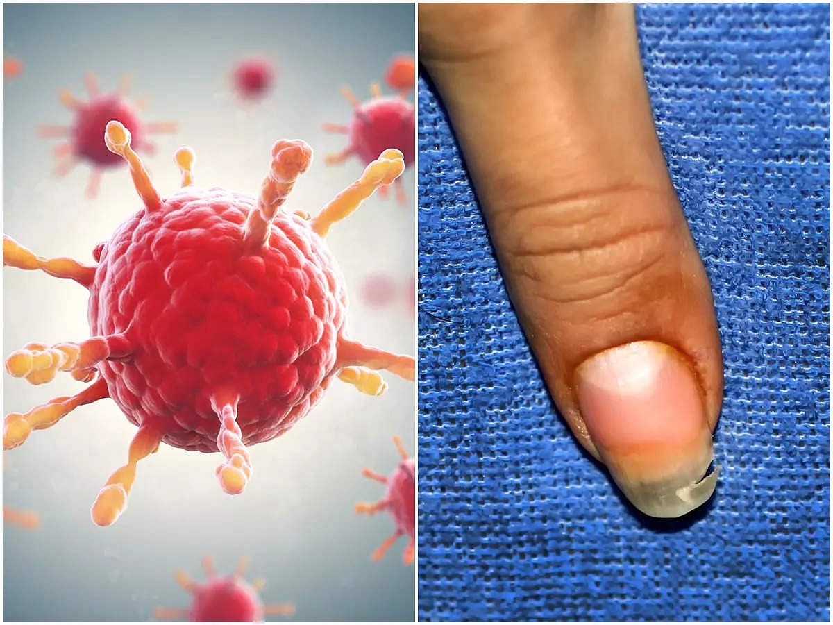 Covid 4th Wave,Covid 4th Wave: ফের করোনা লাফিয়ে বাড়ছে! নখেও দেখা ...