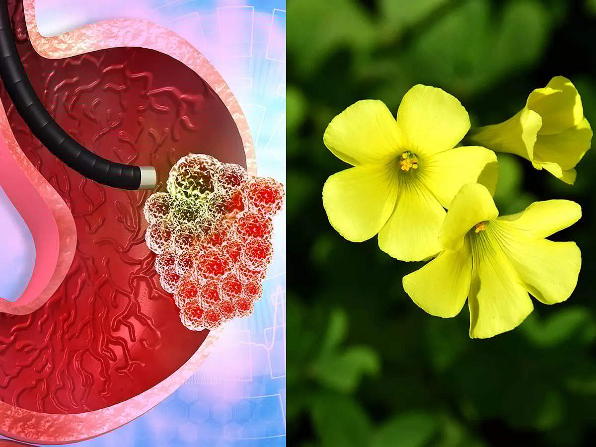 Ayurveda Tips: ডায়ারিয়া, বমি এবং জ্বর থেকে তাৎক্ষণিক উপশম দিতে পারে ...