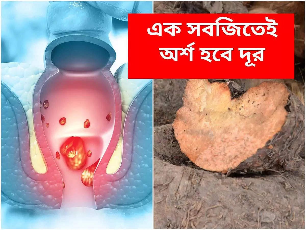 Elephant Foot Yam (Jimikand): কাটাছেঁড়ার প্রয়োজন নেই, এক সবজিতেই ...