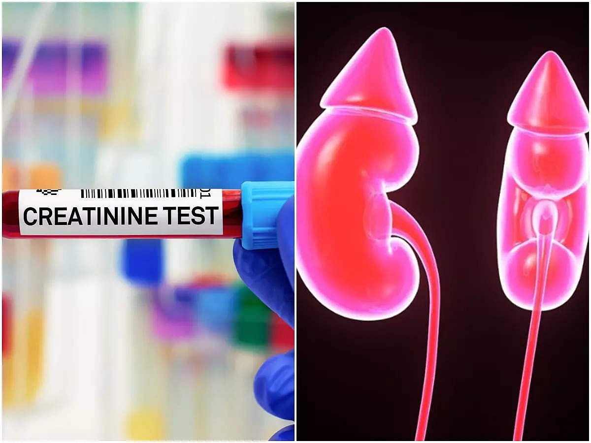 High Creatinine Level: কিডনি ড্যামেজ হলে রক্তে বাড়ে ক্রিয়েটিনিন, এই ...