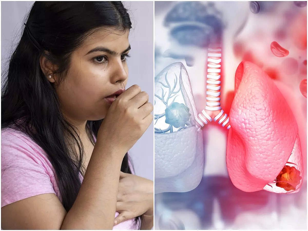 What Are The Difference Between Normal Cough and TB Cough - সাধারণ কাশি ...