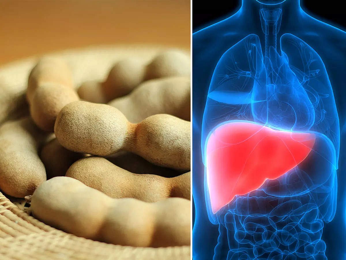How to Use Tamarind for Fatty Liver - ফ্যাটি লিভারে 'ধন্বন্তরি' তেঁতুল ...