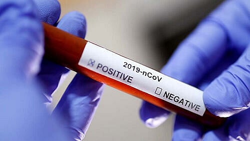 Assam COVID-19 Positive Cases Rise to 58; two more tests Positive