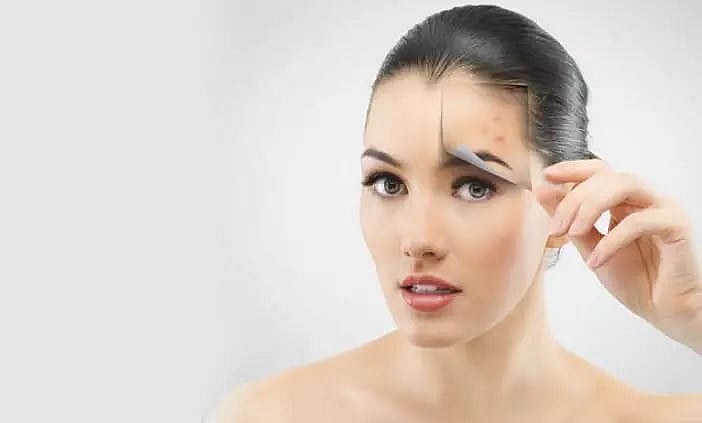 Seven Tips to Treat Dark Spots on Your Body