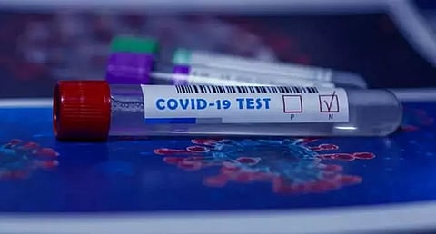 Assam registers 929 fresh COVID-19 cases on Tuesday
