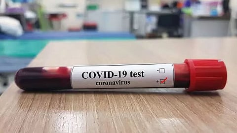 Assam Corona graph: 437 cases detected on Thursday, positivity rate 0.55%