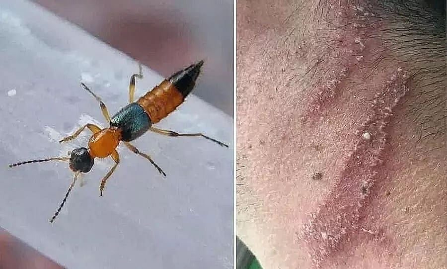 Sikkim:100 Students Fall Prey To Nairobi Flies, All You Need To Know ...