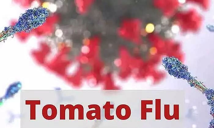 Another Viral On The Block: Tomato Flu Cases Show Worrying Surge