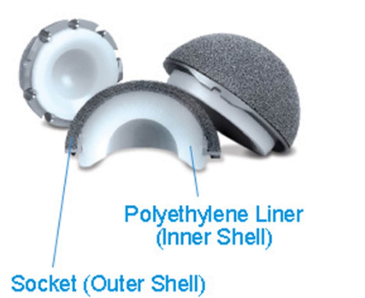 Custom Joint replacements