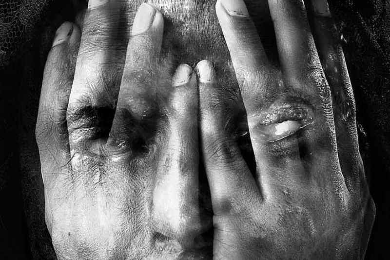 Acid Attack: Lakhimpur Police Arrest Papu Borah and Debojit Pathak