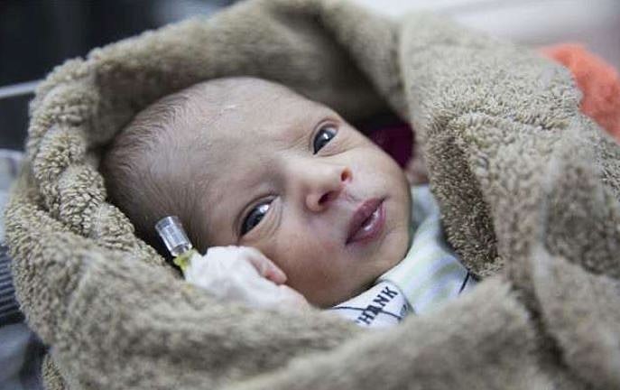 Cause of Disease That Turns Babies’ Lips Blue Identified