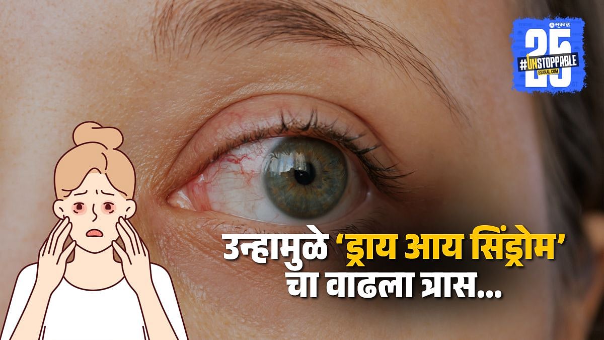 उन्हामुळे ‘ड्राय आय सिंड्रोम’चा वाढला त्रास, काळजी कशी घ्यावी, वाचा ...