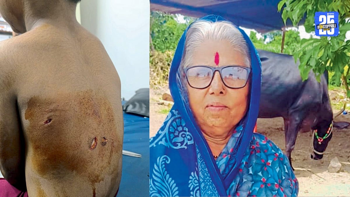 Leopard Attack : सिन्नरमधील बिबट्याच्या हल्ल्यात सहावर्षीय चिमुरडा जखमी; आजीने धाडस दाखवून ...