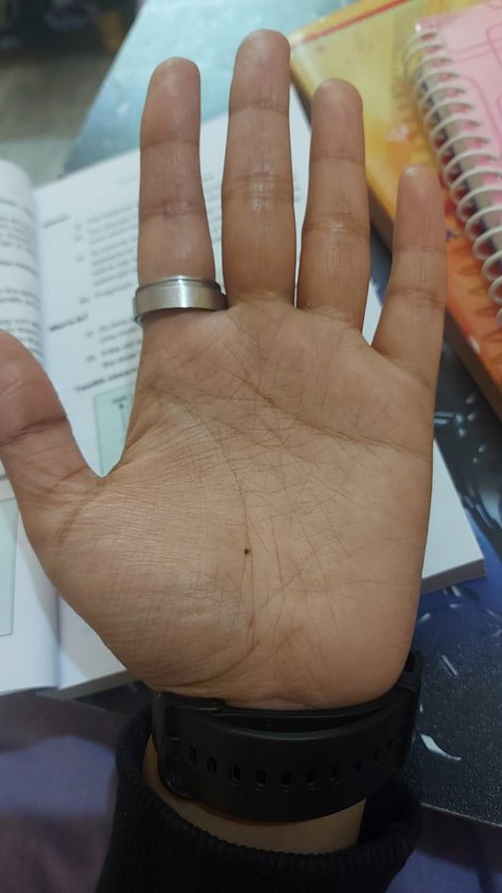 Mole On Palm Astro Tips : तळ हातावर असलेल्या तीळाचा अर्थ माहितीये l ...