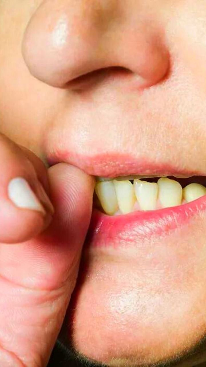 Eating Nails | नखं खाण्याची सवय पडू शकते महागात