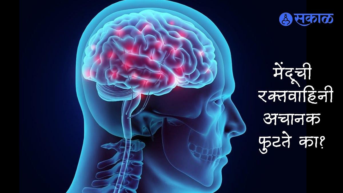 Brain Hemorrhage : मेंदूची रक्तवाहिनी अचानक फुटते का?, आधी काही लक्षणं ...