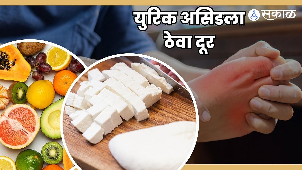 Health Tips- दुधापासून तयार करण्यात आलेल्या या पदार्थांमुळे वाढेल Uric ...