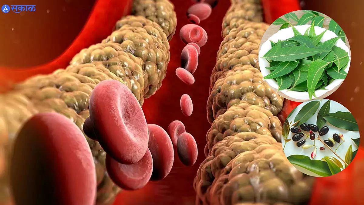 Bad Cholesterol : बॅड कोलेस्ट्रॉलवर रामबाण उपाय आहे आयुर्वेदात ...