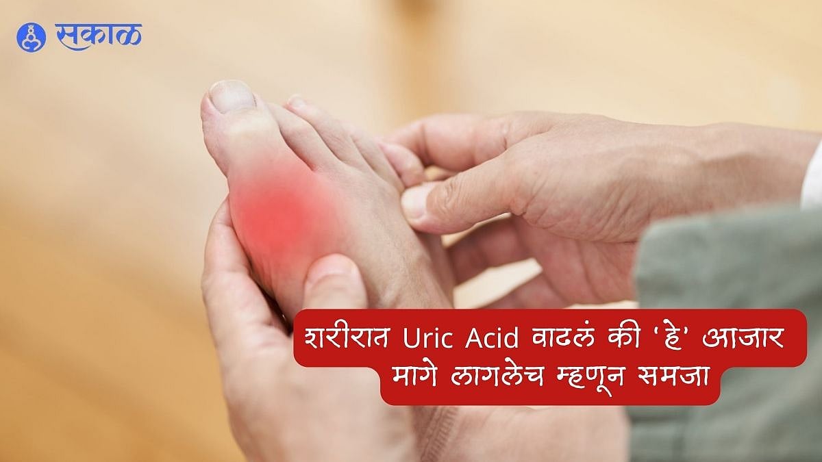 High Uric Acid: शरीरात Uric Acid वाढलं की आजार मागे लागलेच म्हणून समजा ...