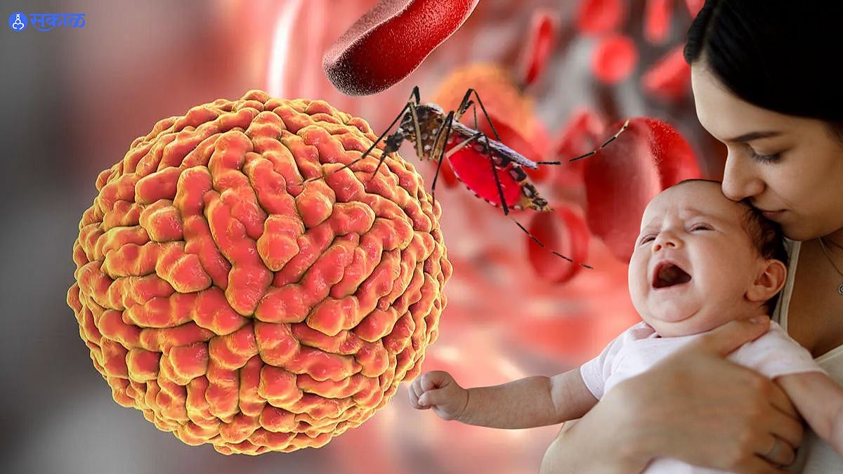 Zika Virus : सावधान! डेंगीचाच डास झिका संसर्गाला कारणीभूत; गर्भवतीला संसर्ग झाल्यास बाळाच्या ...