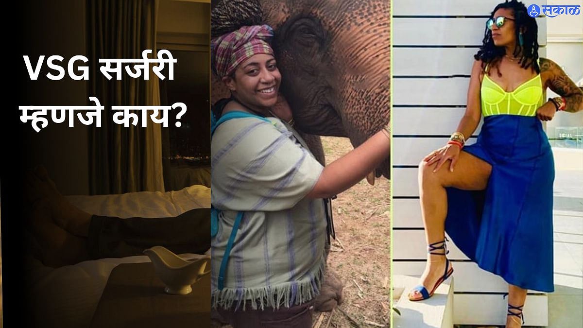 VSG Surgery म्हणजे काय? वजन कमी करण्यासाठी या फोटोग्राफर महिलेने करून ...