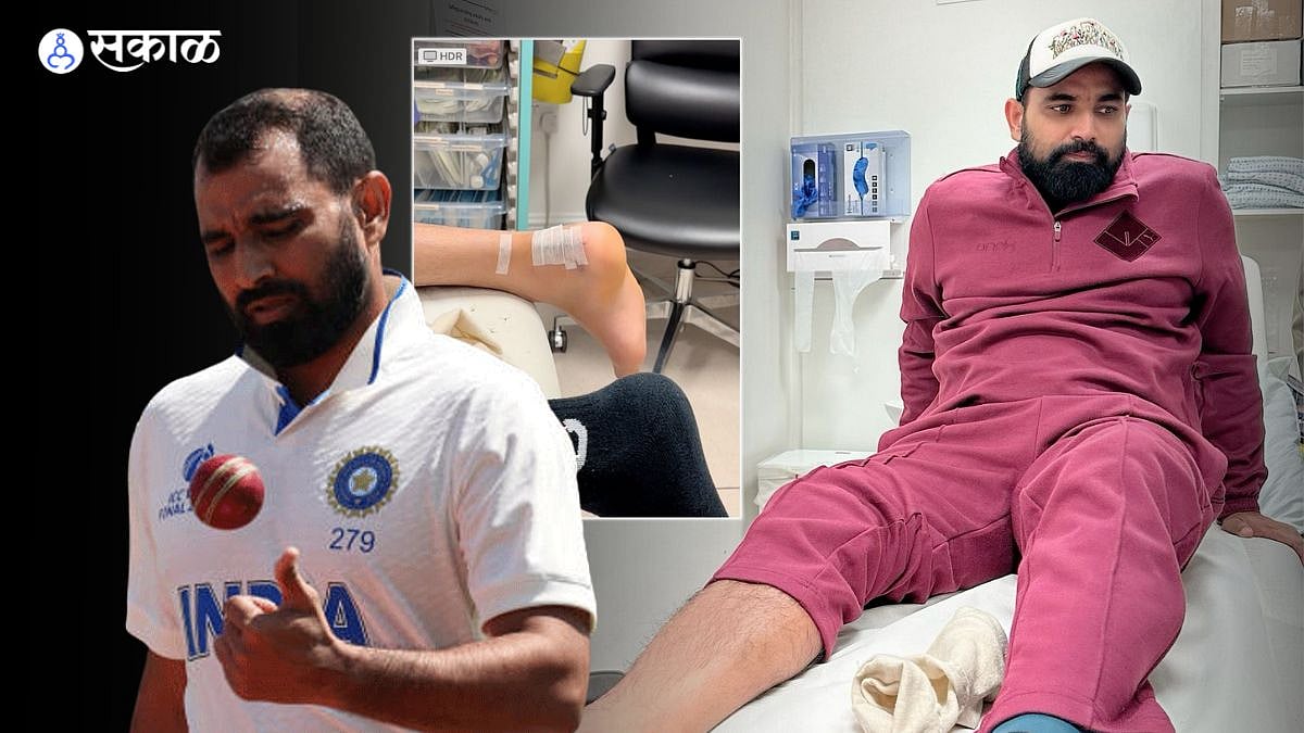 Mohammed Shami Update : 'माझ्या शस्त्रक्रियेला 15 दिवस झाले अन् मी ...