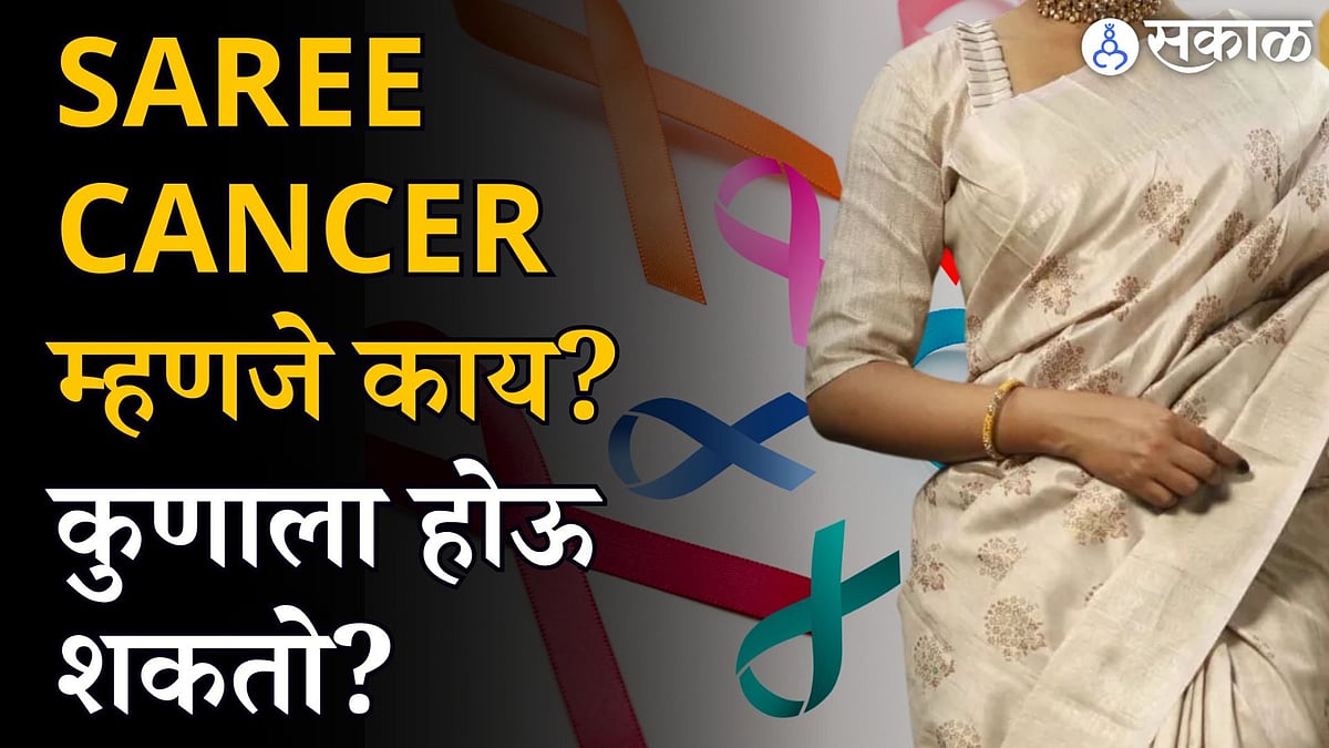 साडी कॅन्सर म्हणजे काय? कुणाला होऊ शकतो साडी कॅन्सर? | What is saree ...