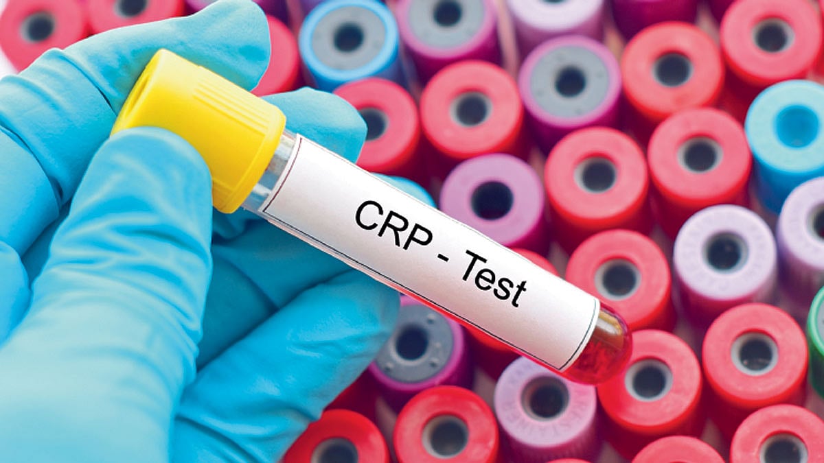 इन्फ्लेमेटरी मार्कर CRP test Inflammatory markers health security