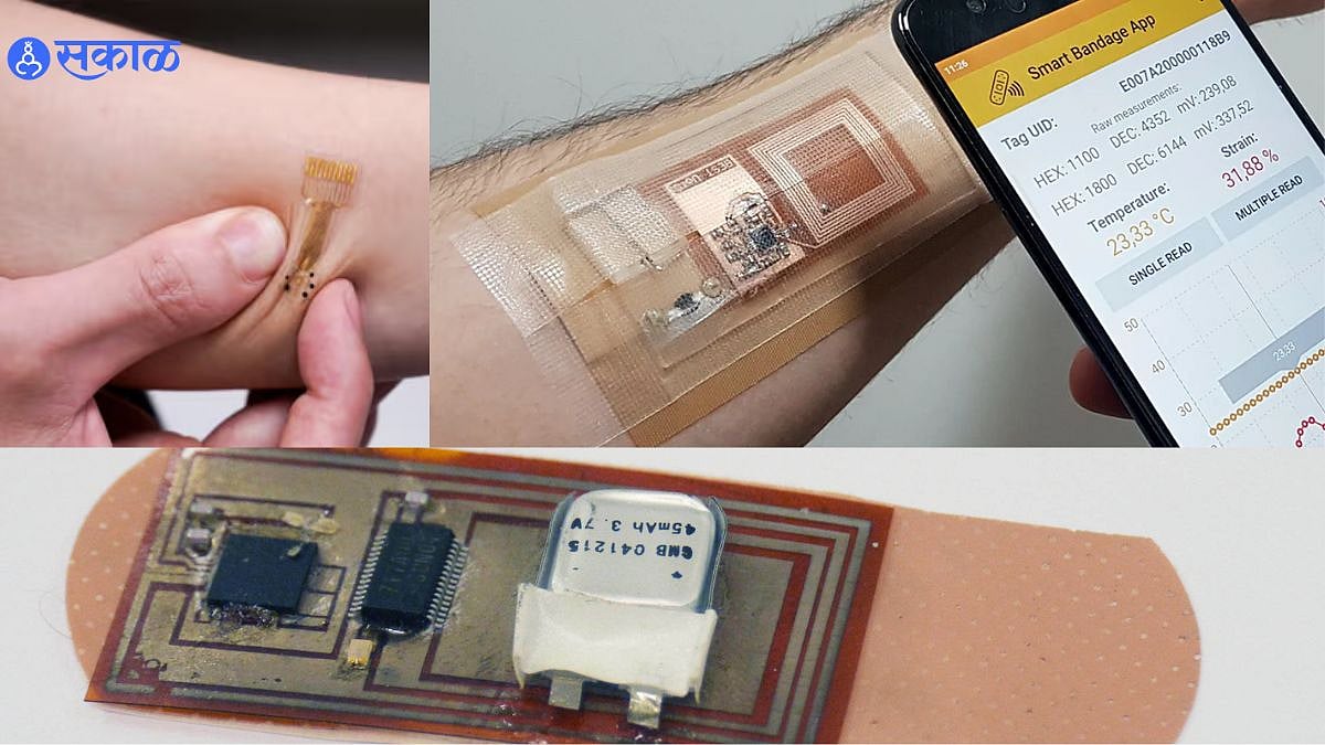 Smart Bandage : आता डॉक्टर इन पॉकेट ; घरबसल्या घेऊ शकणार ट्रीटमेंट ...
