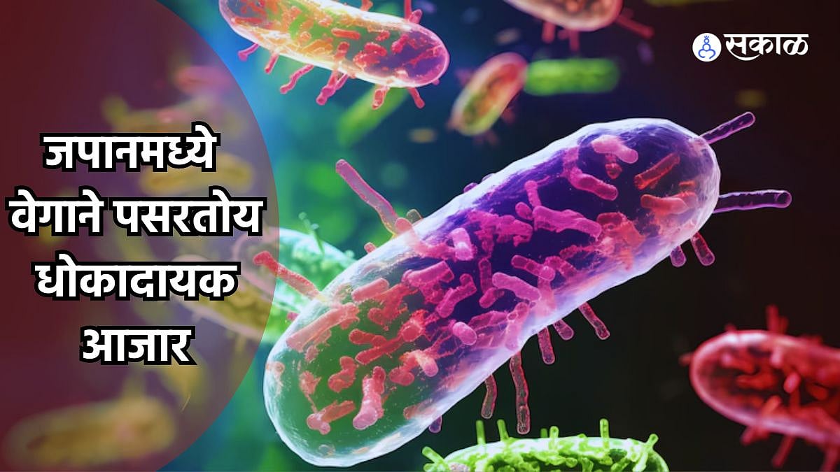 STSS In Japan : बापरे! जपानमध्ये आलाय माणसाचं मांस खाणारा धोकादायक आजार ...