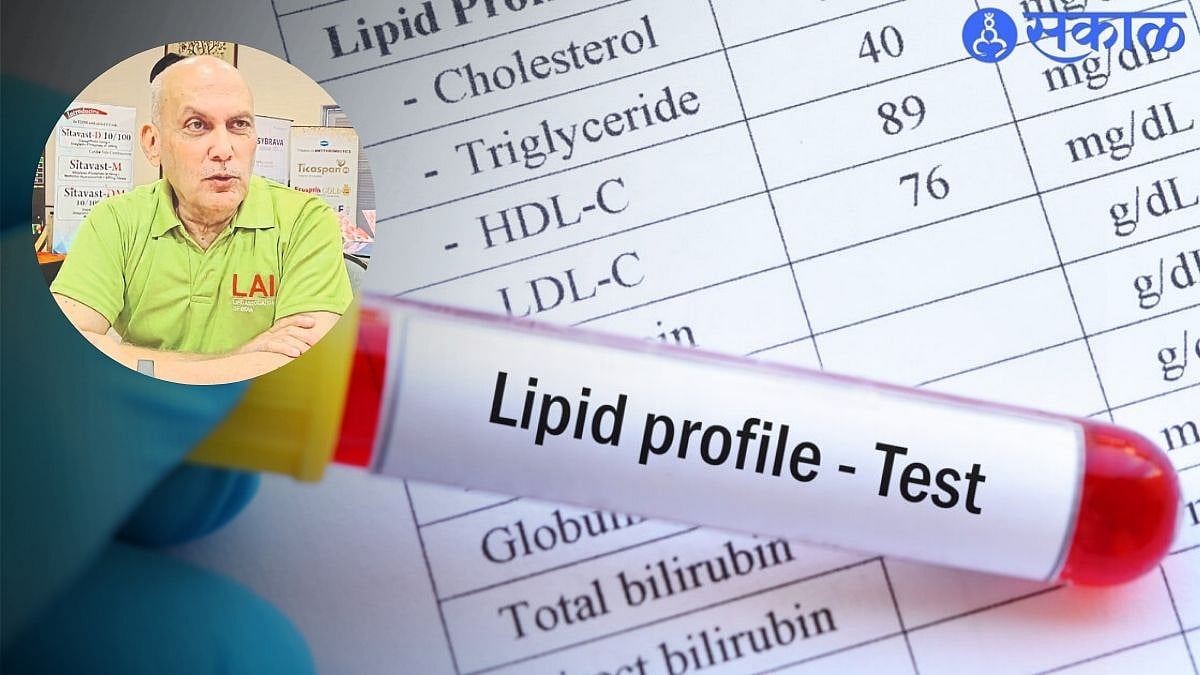 Lipid Profile Test : लिपिड प्रोफाइल तपासणी विशीतच करा : डॉ. रमण पुरी ...